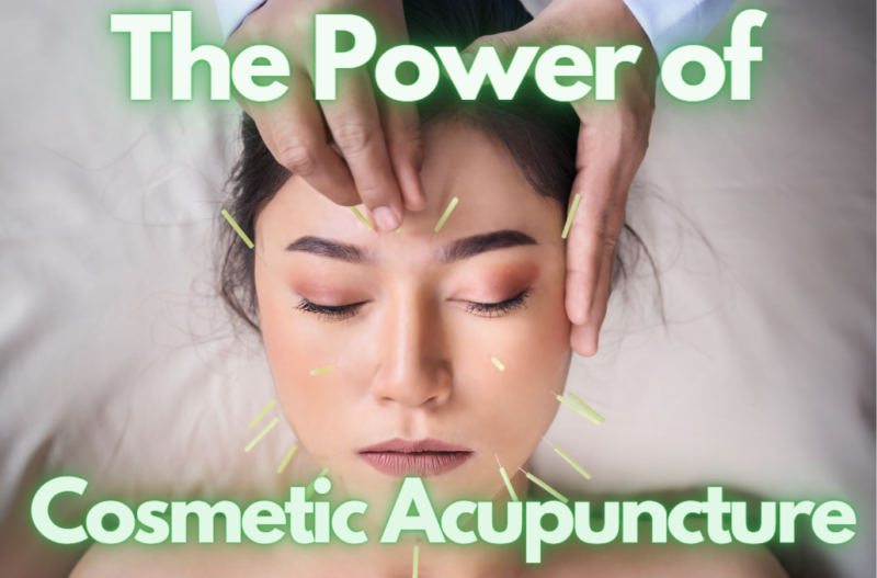 What Is Cosmetic Acupuncture : What is Cosmetic Acupuncture and How Can ...