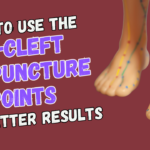 The 13 GHOST Points in Acupuncture